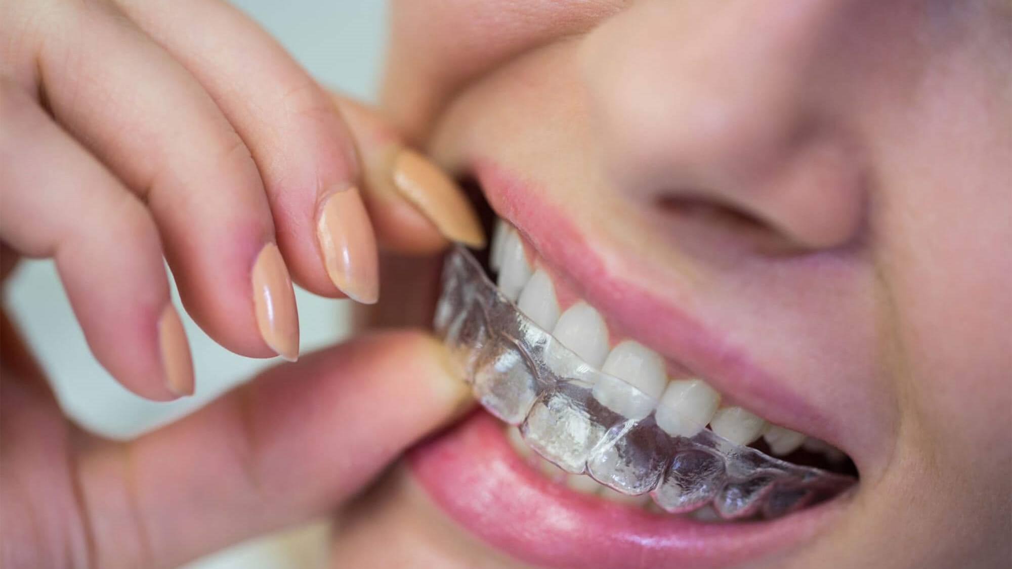 Common Orthodontic Problems & How They’re Treated